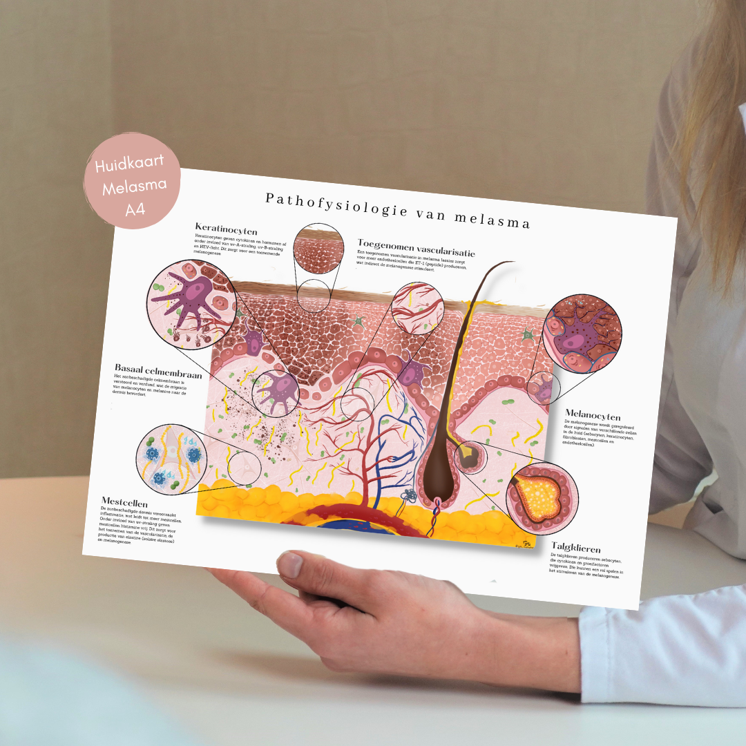 Melasma skin map: detailed anatomical pathophysiology - educational to ...